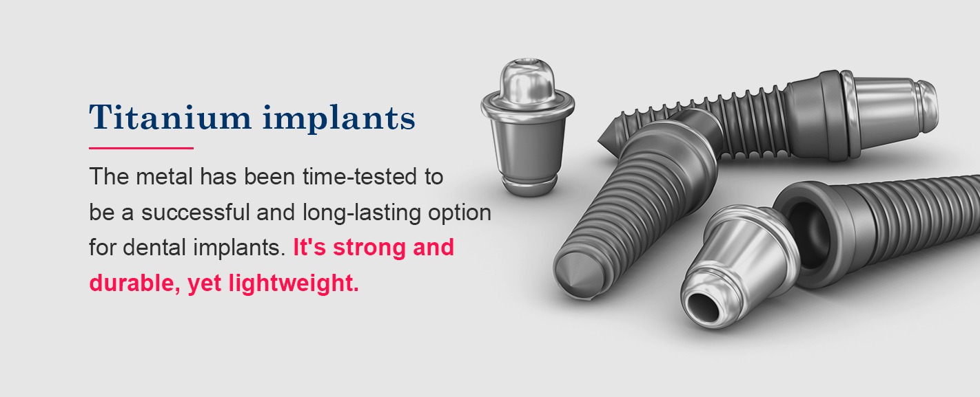 The Ultimate Guide to Titanium Implants: Enhance Your Smile and Restore ...